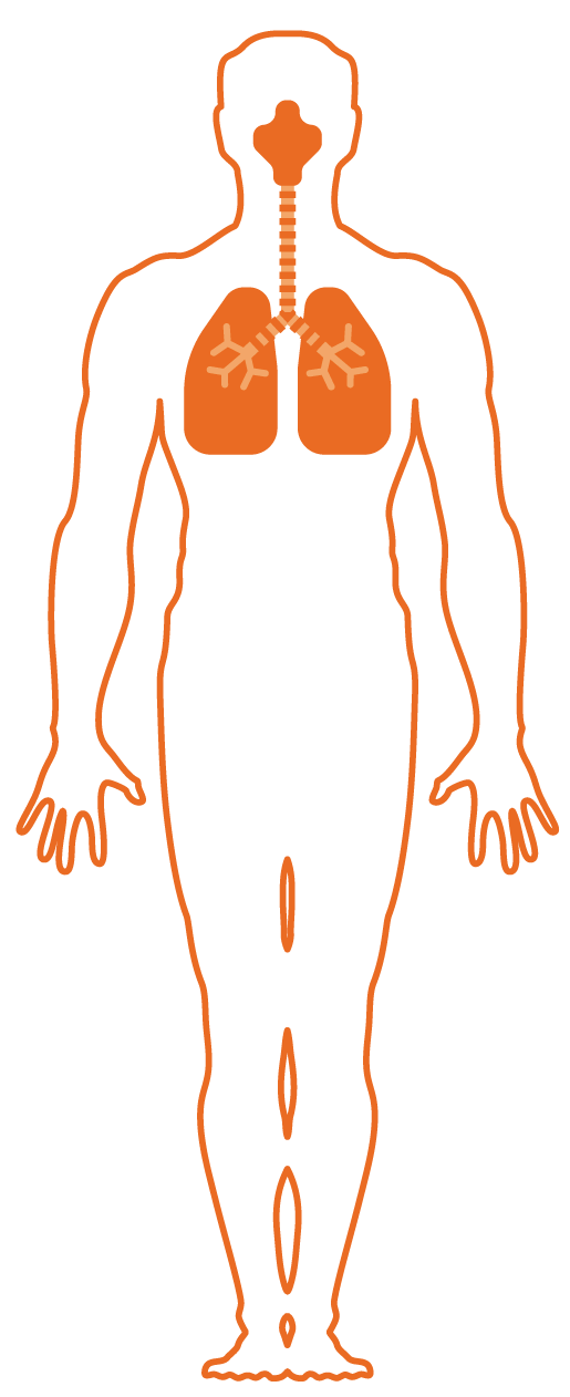 Chemical Weapons: A Deadly History - Radio Free Europe / Radio Liberty